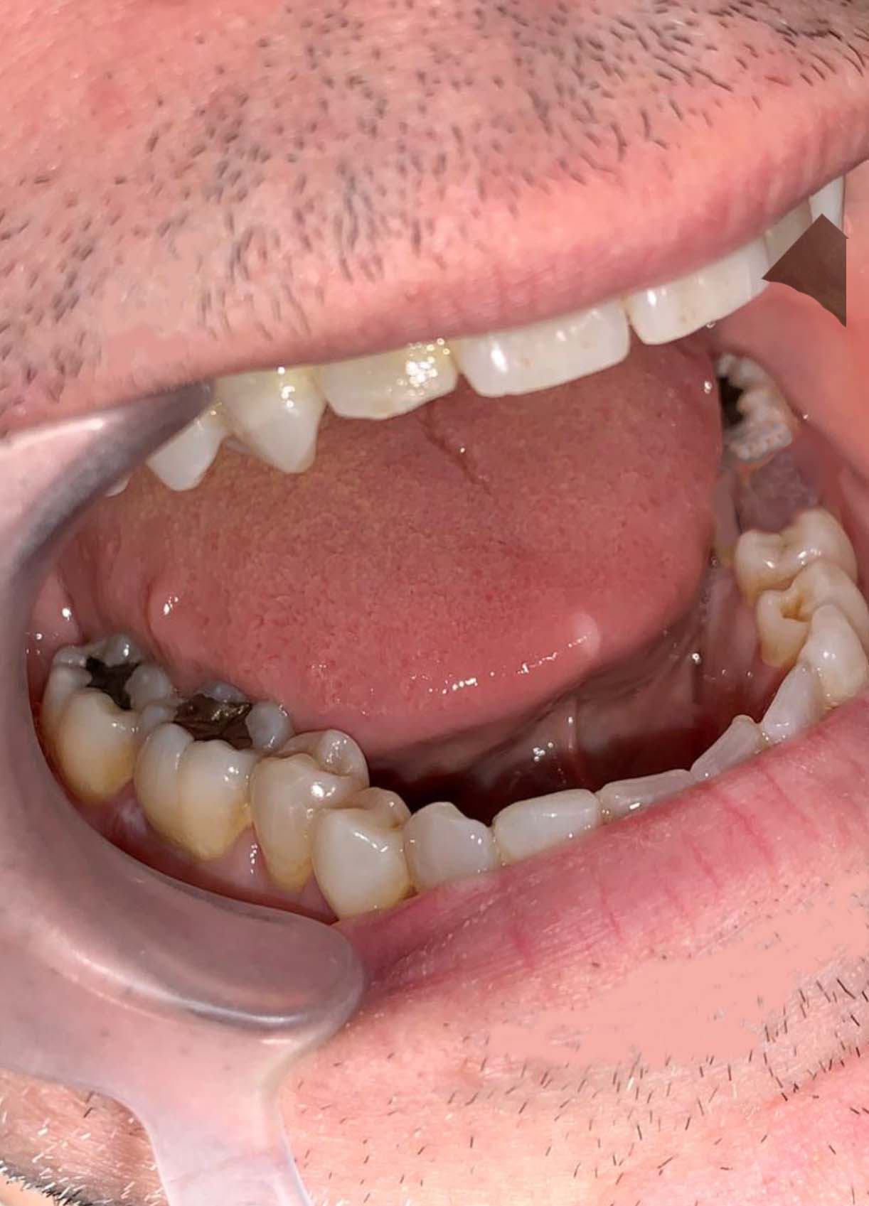 Patient Connector - DentSim
