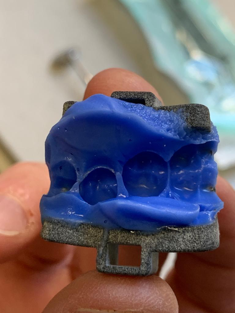 Patient Connector - DentSim